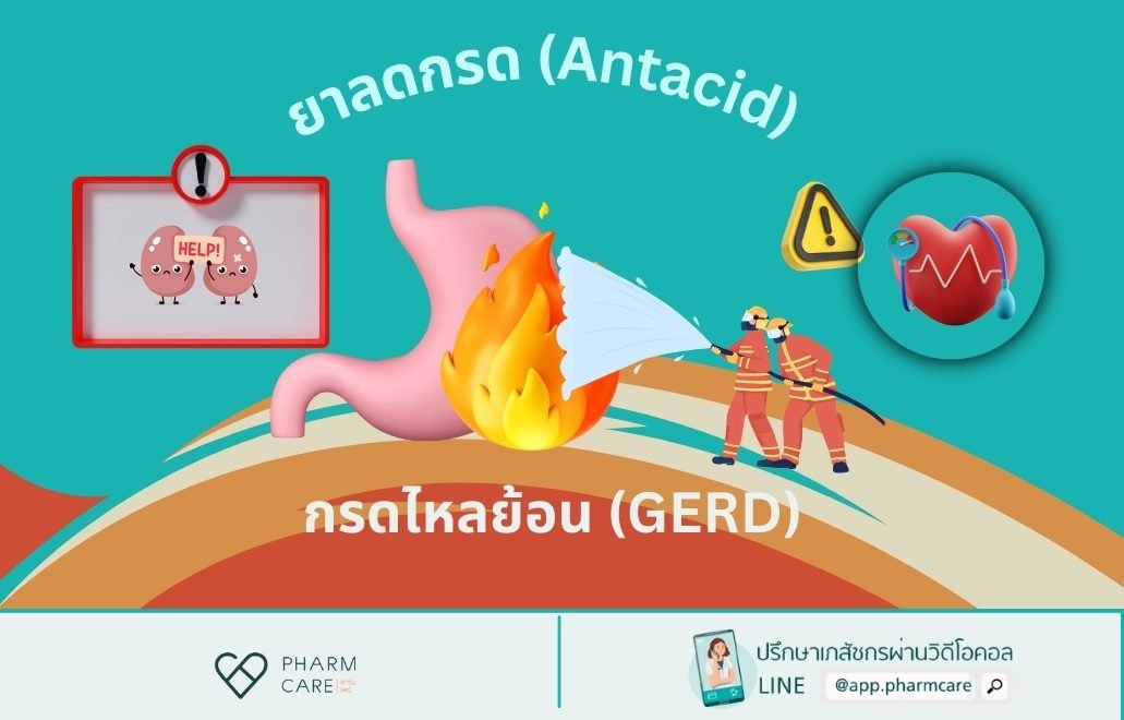 เมื่อเป็นกรดไหลย้อน ใช้ยาลดกรด (Antacid) อย่างไรจึงปลอดภัย